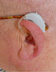 PSAPS vs Hearing Aids - Main Differences | Livingston, NJ & Near Me